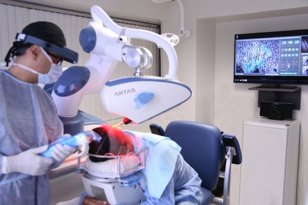 ARTAS Robotic Hair Transplant | Robotic FUE Technology