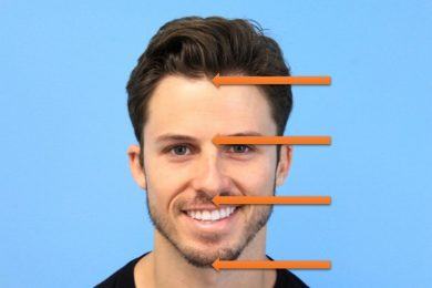 Simplified Hairline Design – A Focus on Shape and Position